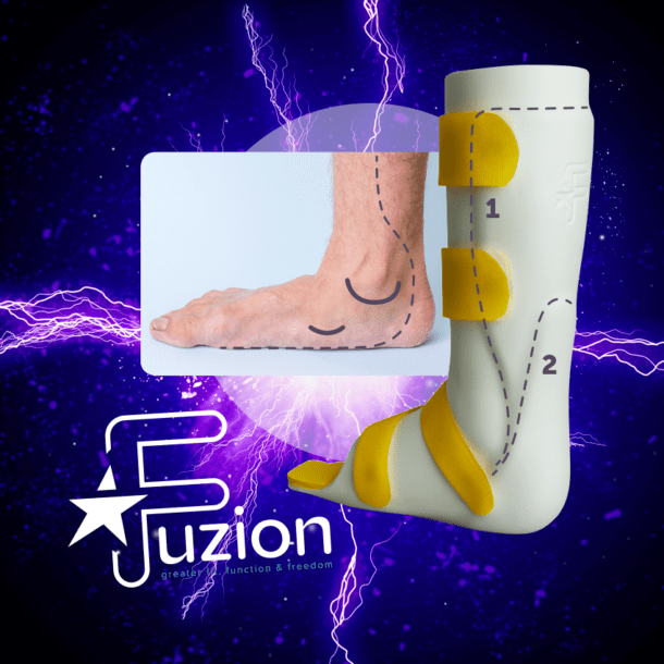 New Fuzion AFO Strut Options - Orthomerica Products, Inc.